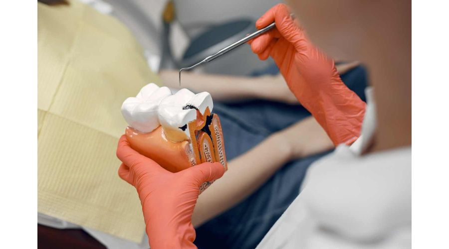 Plomba dentara: ghid complet despre plomba la masea si materialele ...